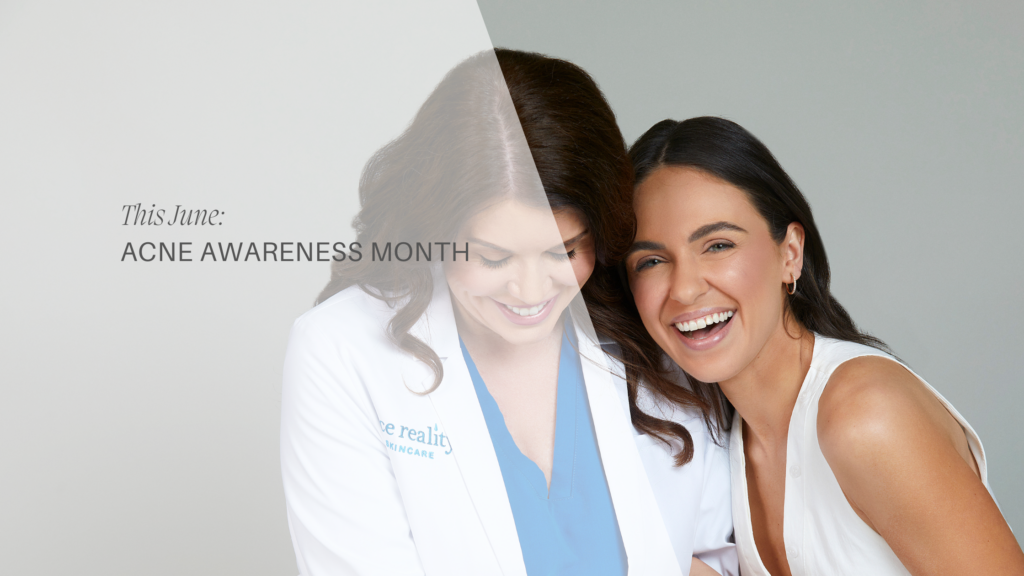 Clear Skin, Clear Confidence: Understanding and Treating Acne During ...